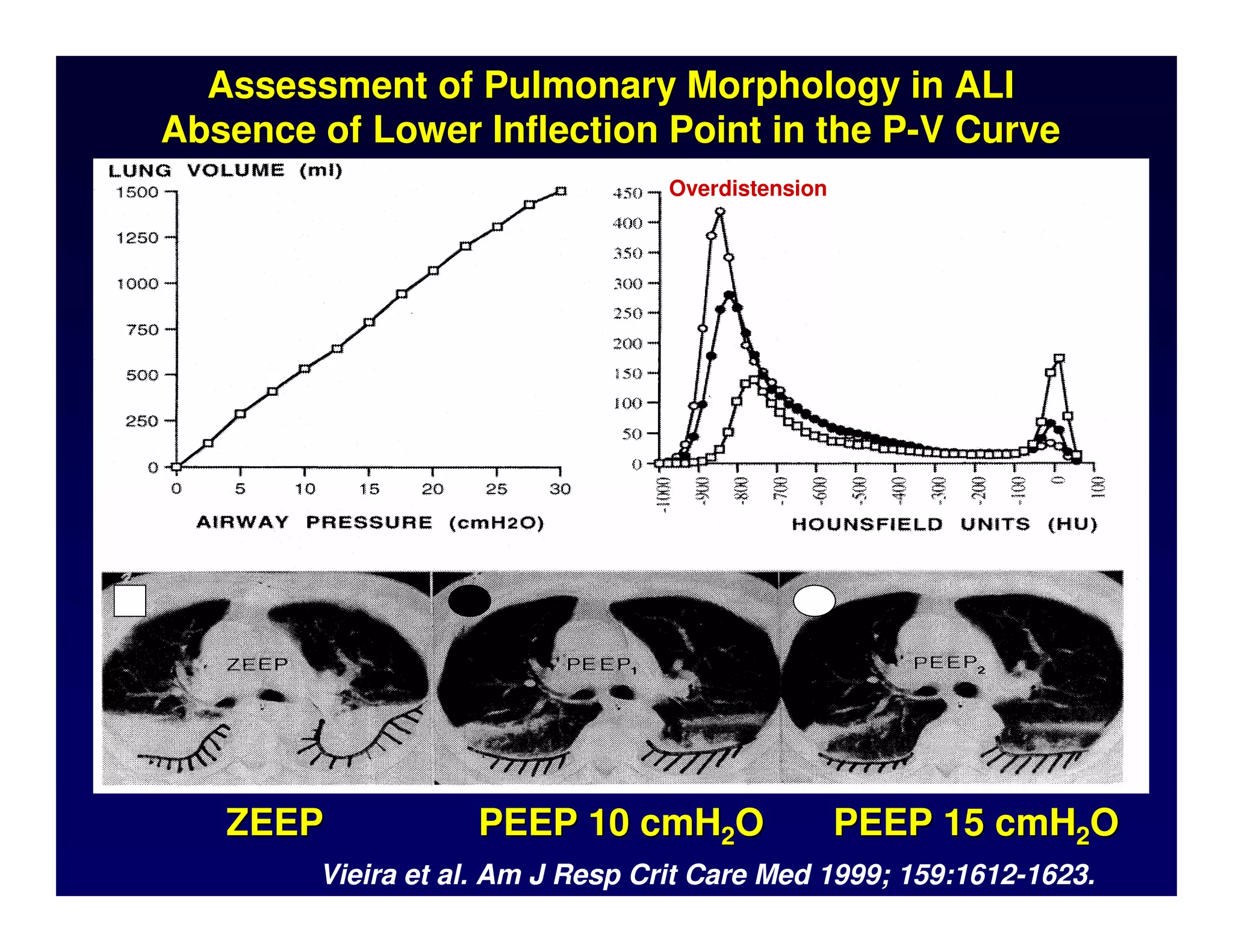 Pressure-Volume Curves in ARDS:Are they Useful? | PDF