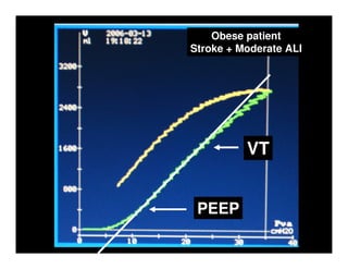 Pressure-Volume Curves in ARDS:Are they Useful? | PDF
