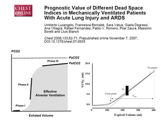 Under Appreciated Signs In Ventilator Monitoring | PPT