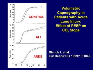 Under Appreciated Signs In Ventilator Monitoring | PPT