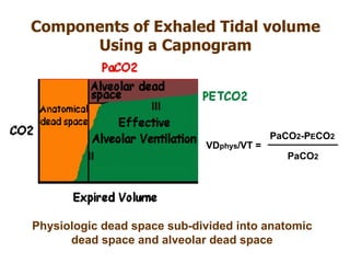 Under Appreciated Signs In Ventilator Monitoring | PPT