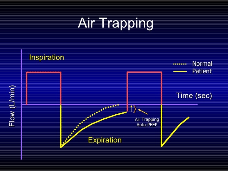 Lung Mechanics Beyond Basics
