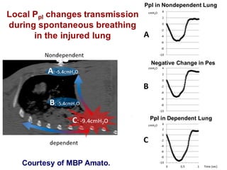 Novel Mechanical Ventilation Strategies | PPT