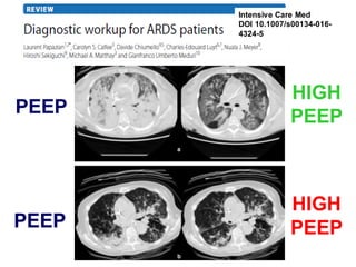 Novel Mechanical Ventilation Strategies | PPT