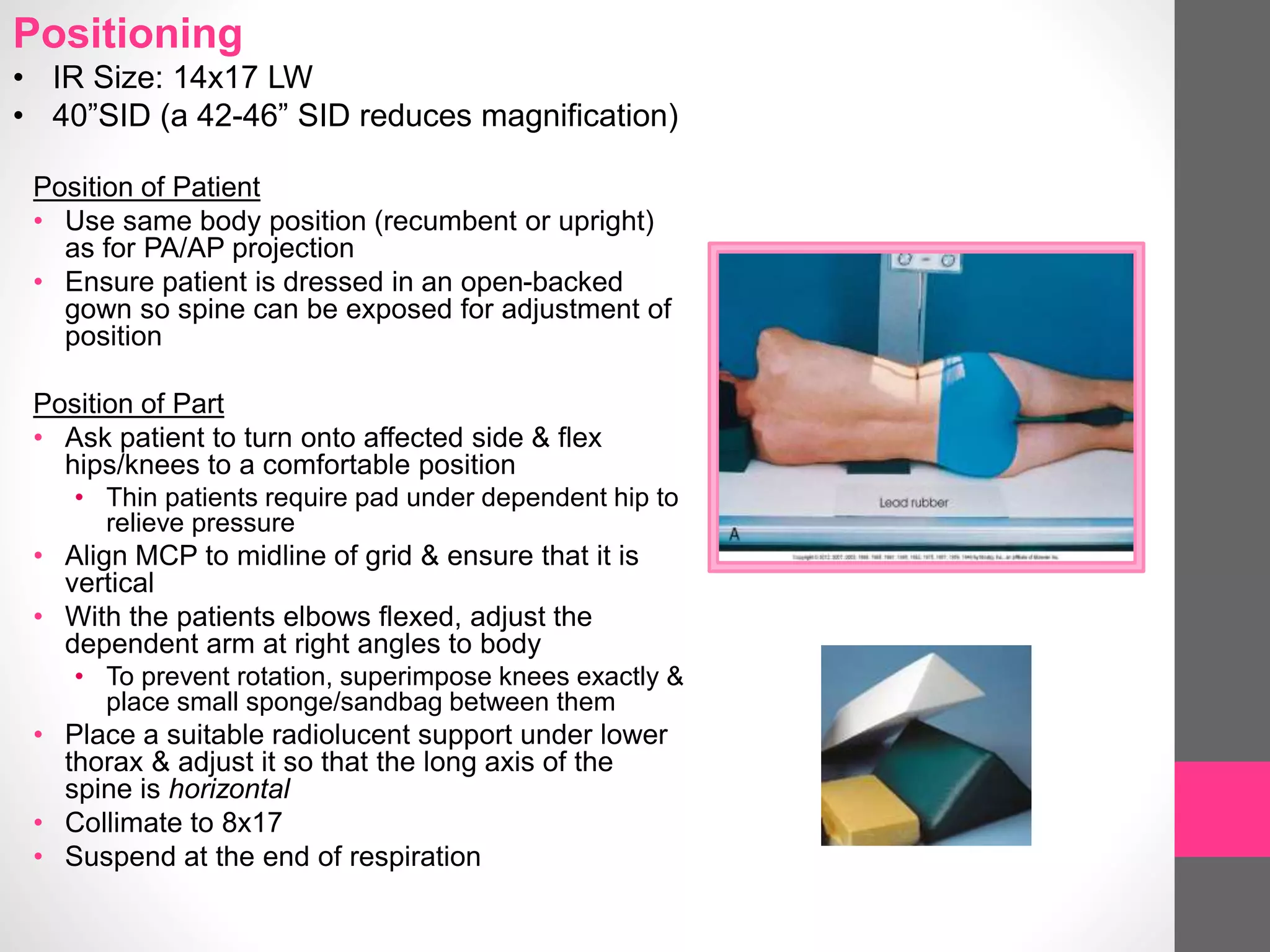 Final Image Evaluation: Left Lateral Lumbar Spine | PPTX