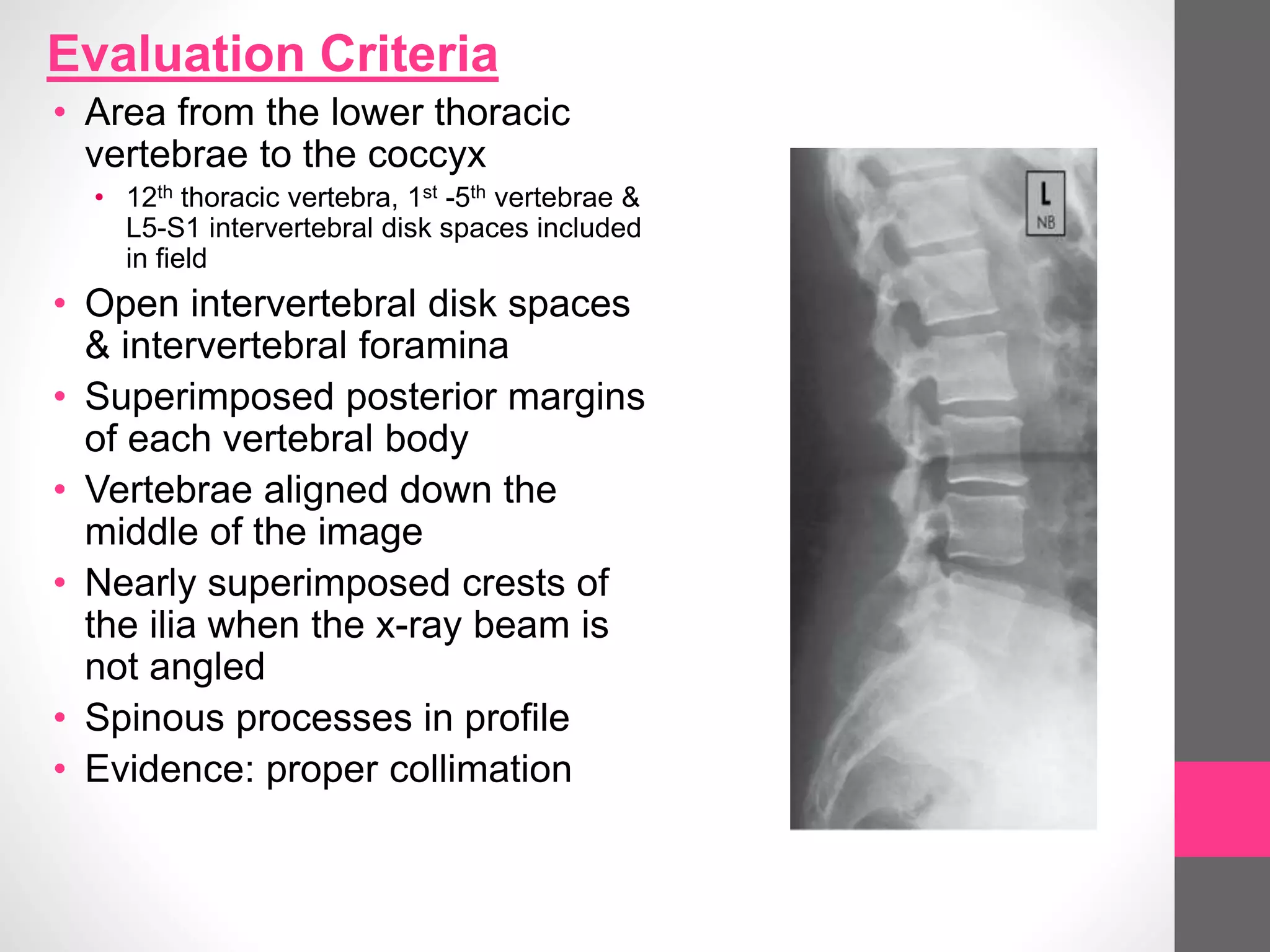 Final Image Evaluation: Left Lateral Lumbar Spine | PPTX