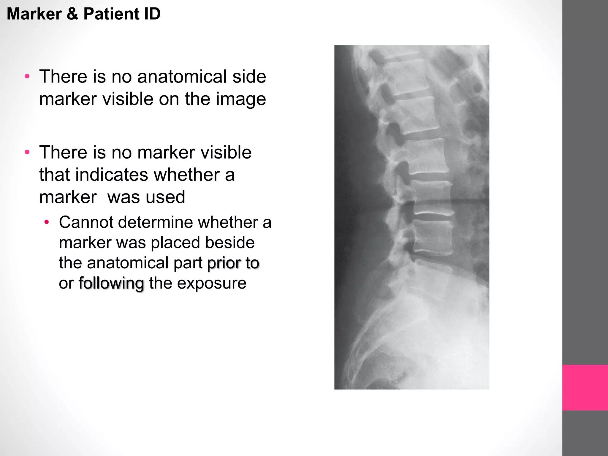 Final Image Evaluation: Left Lateral Lumbar Spine | PPTX
