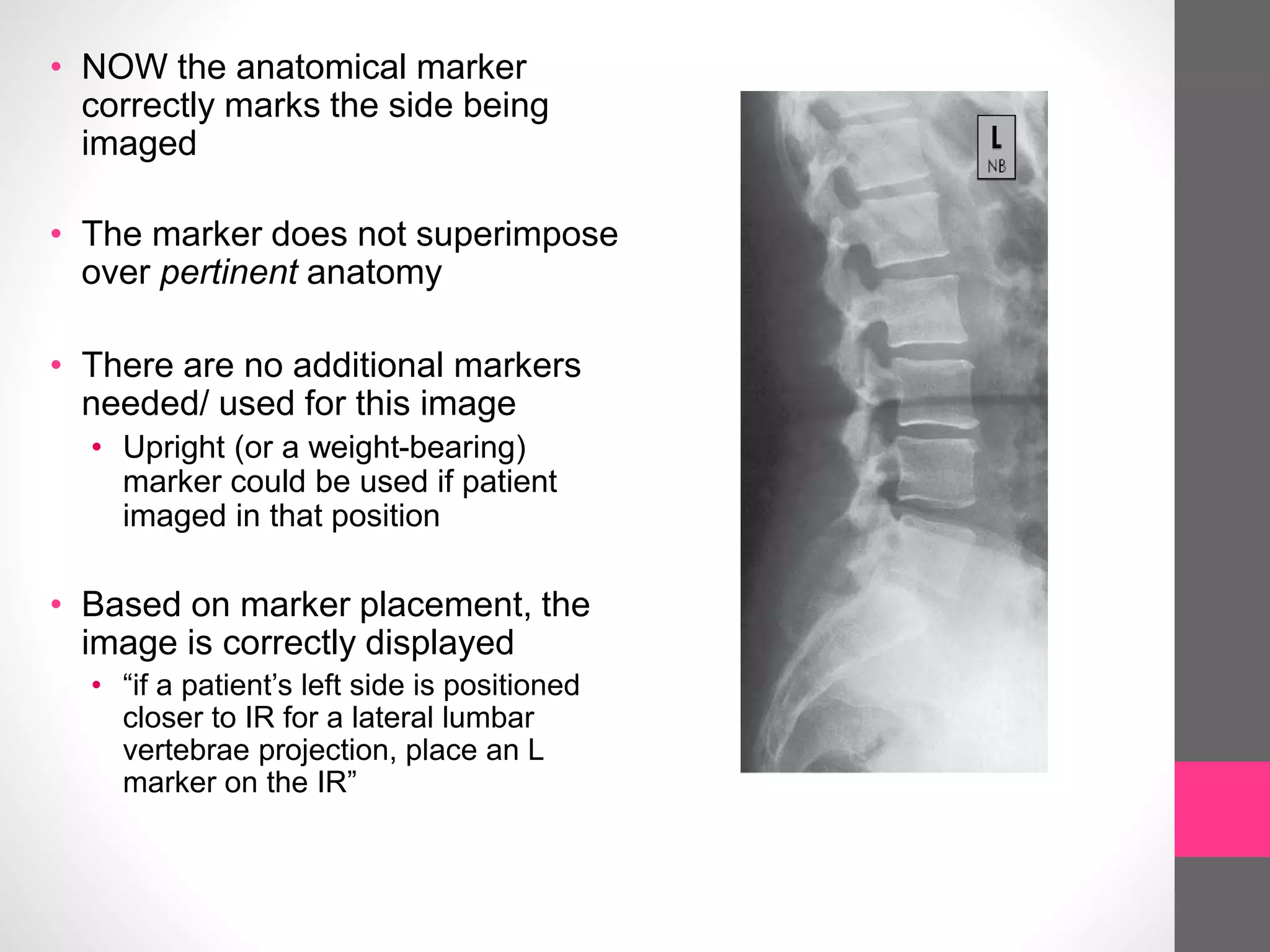 Final Image Evaluation: Left Lateral Lumbar Spine | PPTX