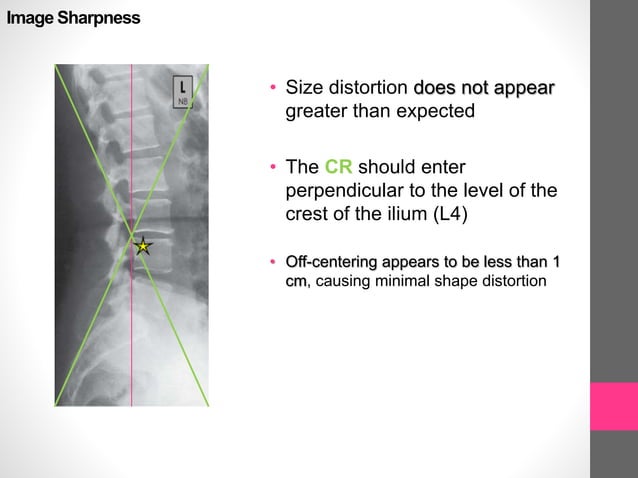 Final Image Evaluation: Left Lateral Lumbar Spine | PPTX