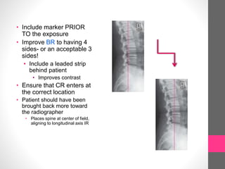 Final Image Evaluation: Left Lateral Lumbar Spine | PPTX