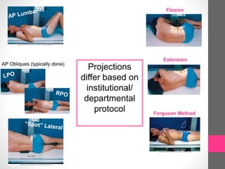 Final Image Evaluation: Left Lateral Lumbar Spine | PPTX