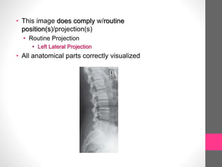 Final Image Evaluation: Left Lateral Lumbar Spine | PPTX
