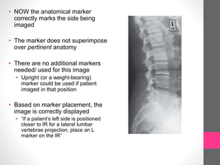 Lateral Lumbar Spine Xray