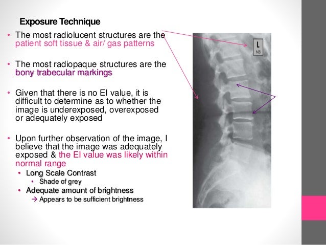 Final Image Evaluation: Left Lateral Lumbar Spine
