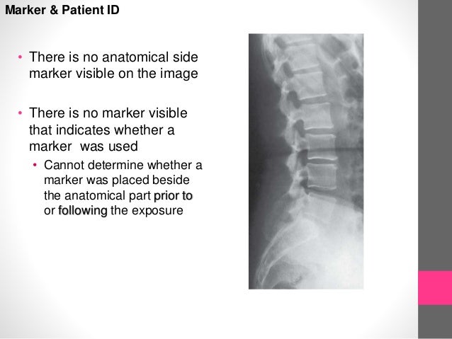 Final Image Evaluation: Left Lateral Lumbar Spine