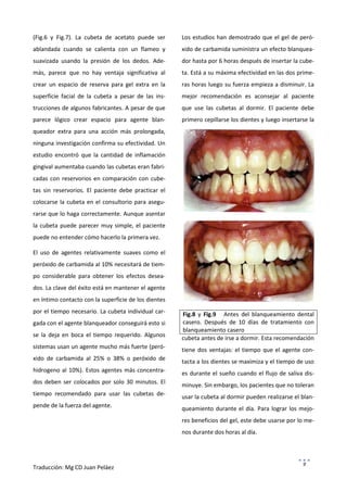 Blanqueamiento dental | PDF
