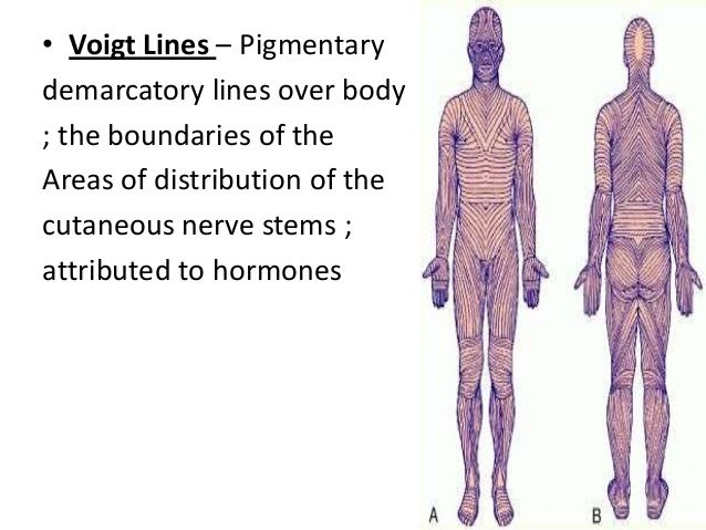 Blaschkoid dermatitis