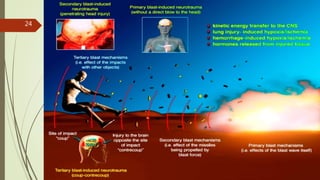 Explosion Injuries and its Forensic Aspect | PPTX