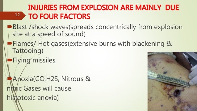 Explosion Injuries and its Forensic Aspect