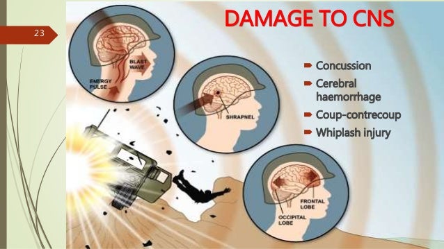 Explosion Injuries and its Forensic Aspect