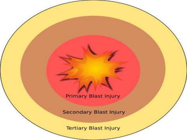 Blast injuries