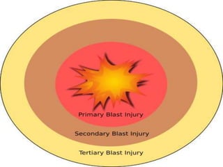 Blast injuries | PPTX
