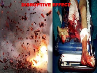 Blast injuries | PPTX