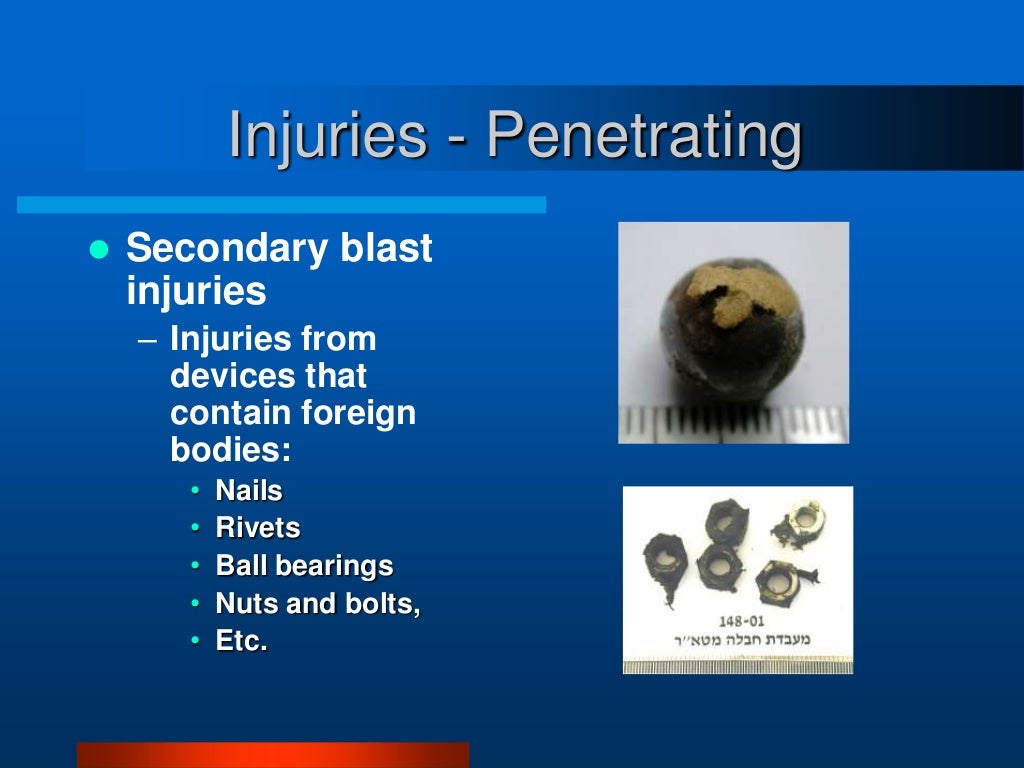 Blast injuries