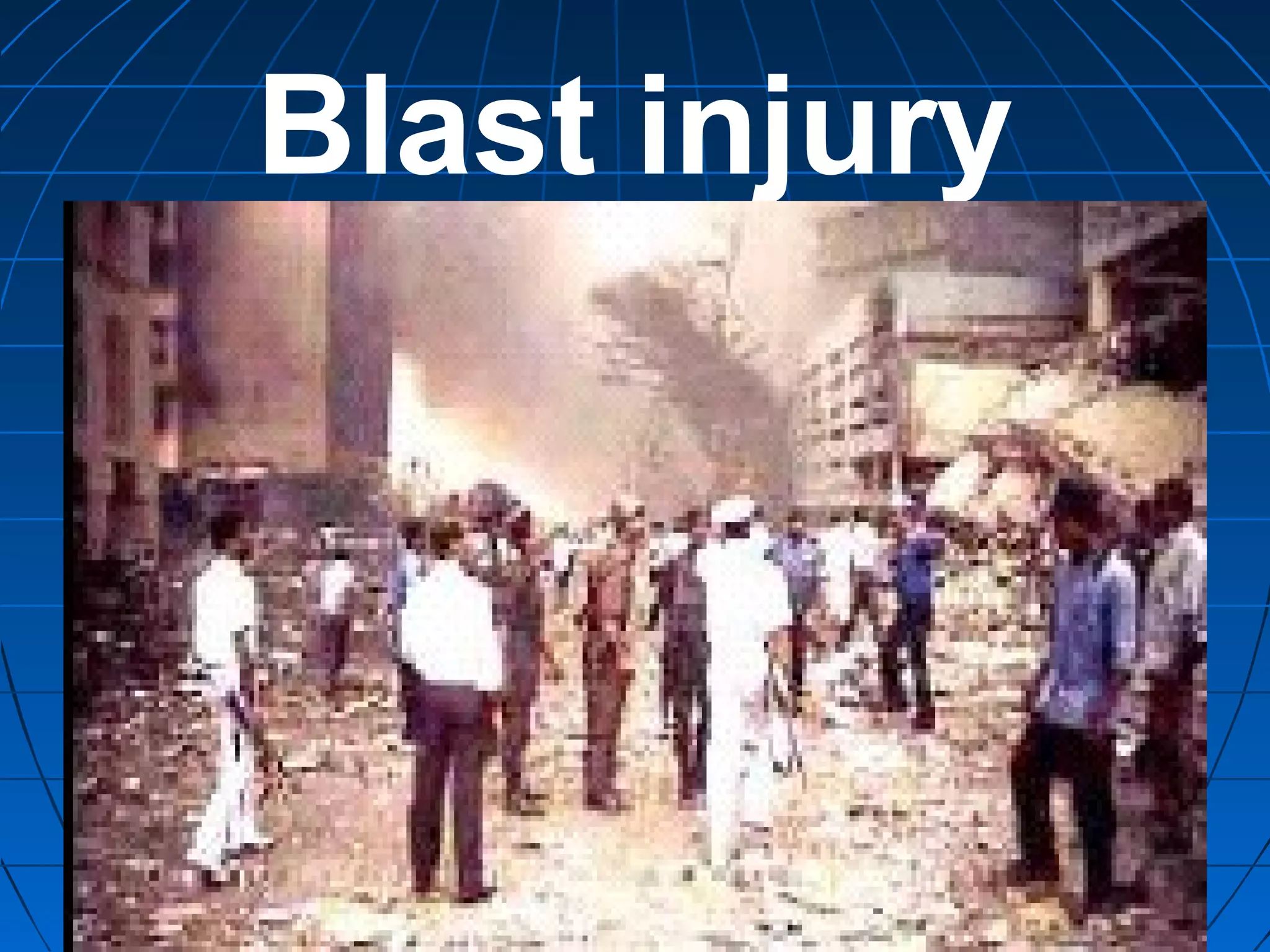 Blast injuries | PPT