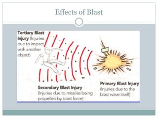 Blast injuries | PPTX