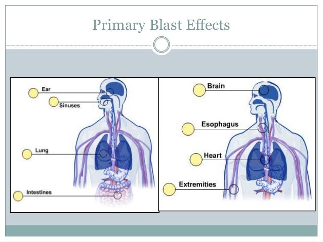 Blast Injuries