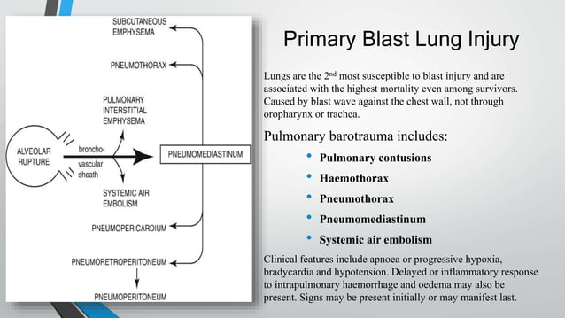 Blast Injury | PPTX
