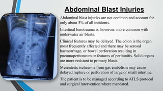 Blast Injury | PPTX
