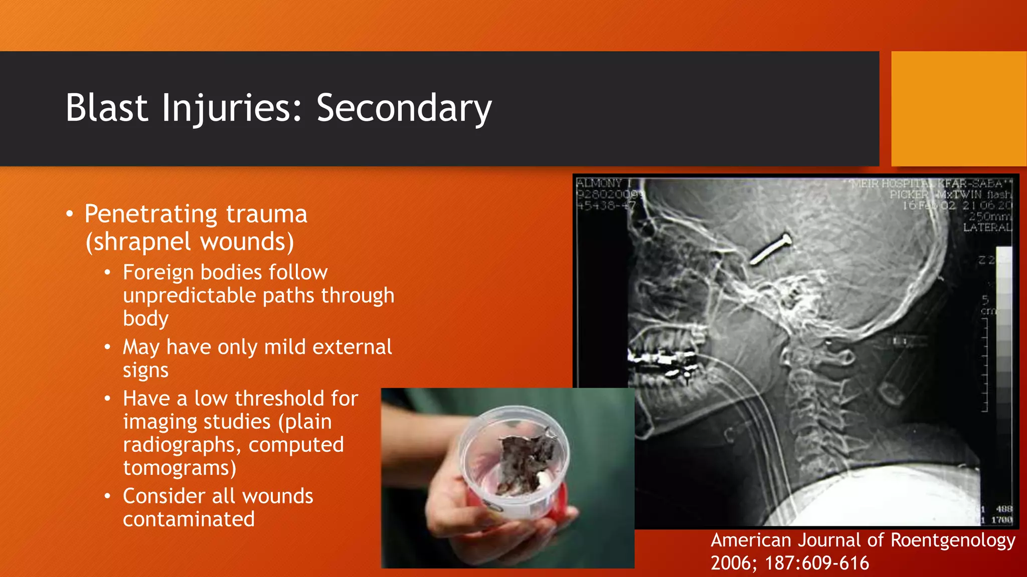 Blast Injury Management.pptx