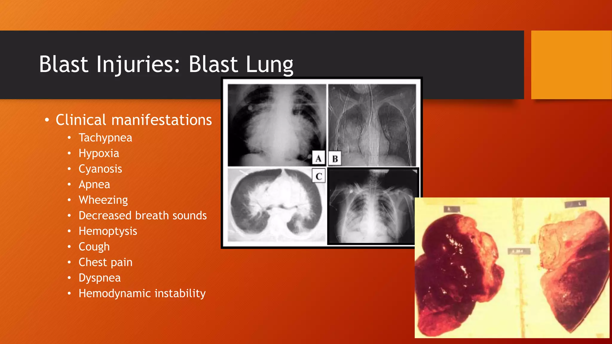 Blast Injury Management.pptx