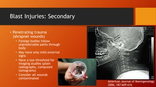 Blast Injury Management.pptx