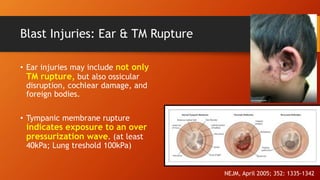 Blast Injury Management.pptx