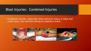 Blast Injury Management.pptx