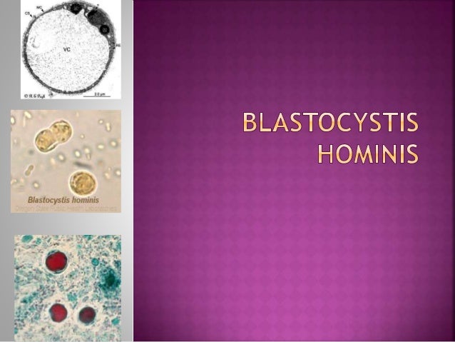 Blastocystis Hominis Treatment