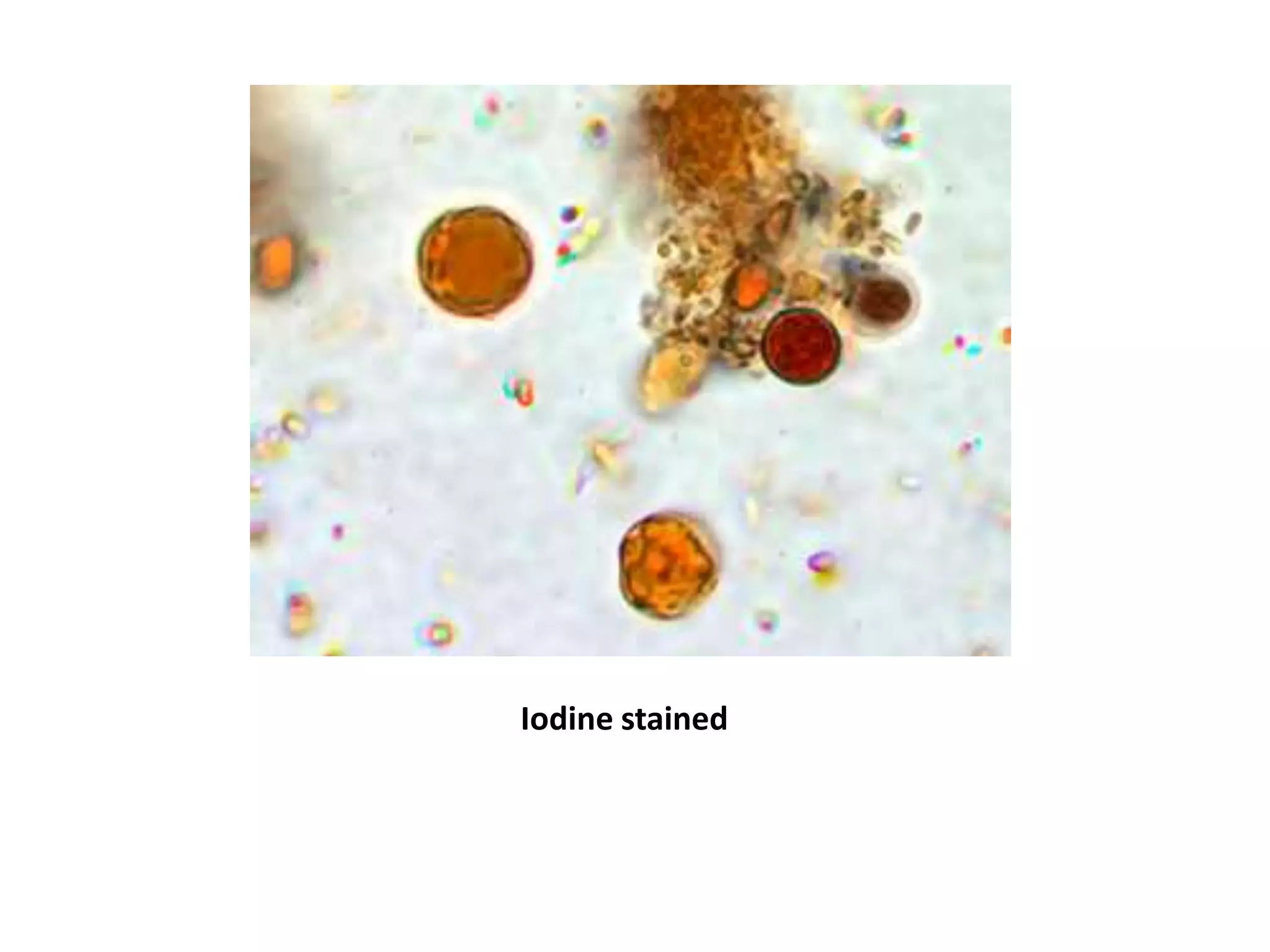 Blastocystis hominis and e. polecki | PPTX