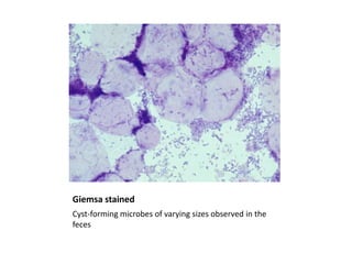 Blastocystis hominis and e. polecki | PPTX