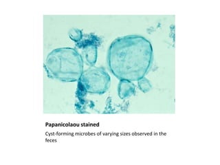 Blastocystis hominis and e. polecki | PPTX