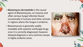 BLASTOMYCETES .pptx