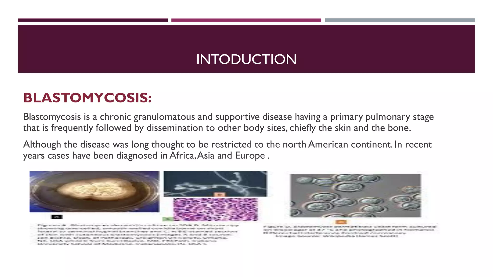 BLASTOMYCOSIS.pdf