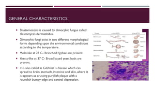 BLASTOMYCOSIS.pdf