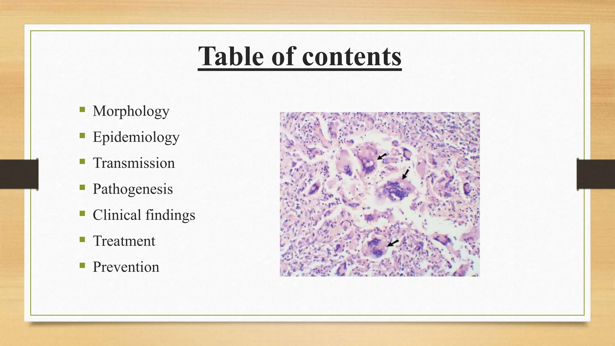 BLASTOMYCOSIS.pptx prepare by rehan asghar | PPTX | Infectious Diseases ...