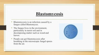 BLASTOMYCOSIS.pptx prepare by rehan asghar | PPTX