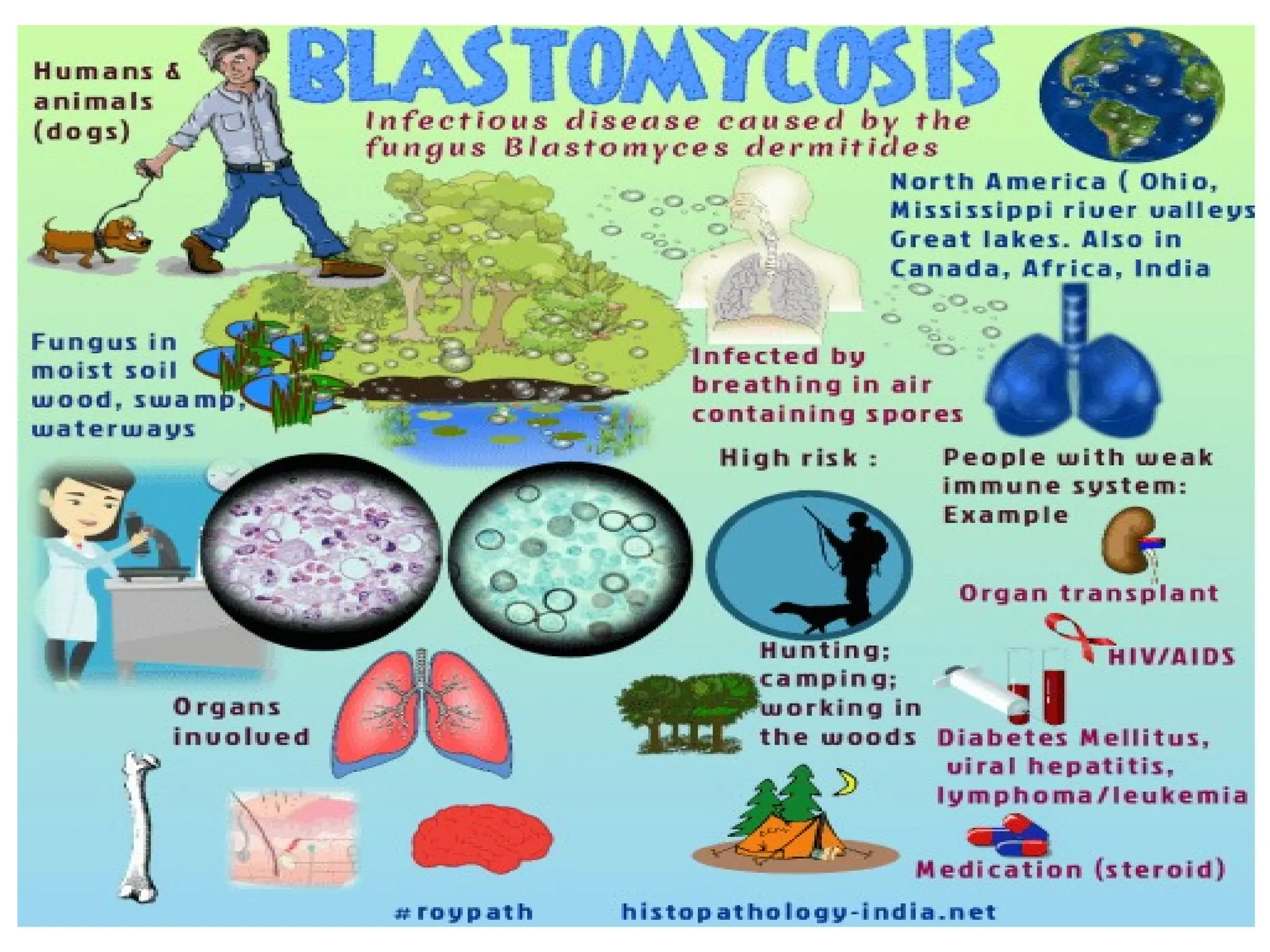 A comprehensive Ppt on Blastomycosis.pptx