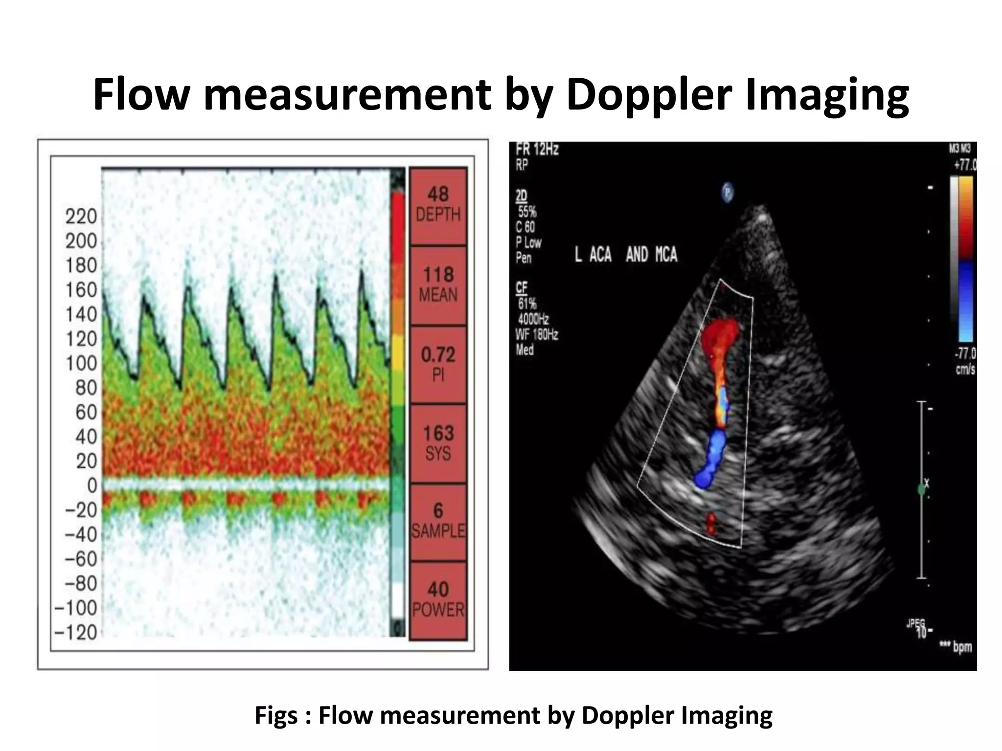 blood flow measurement | PPTX