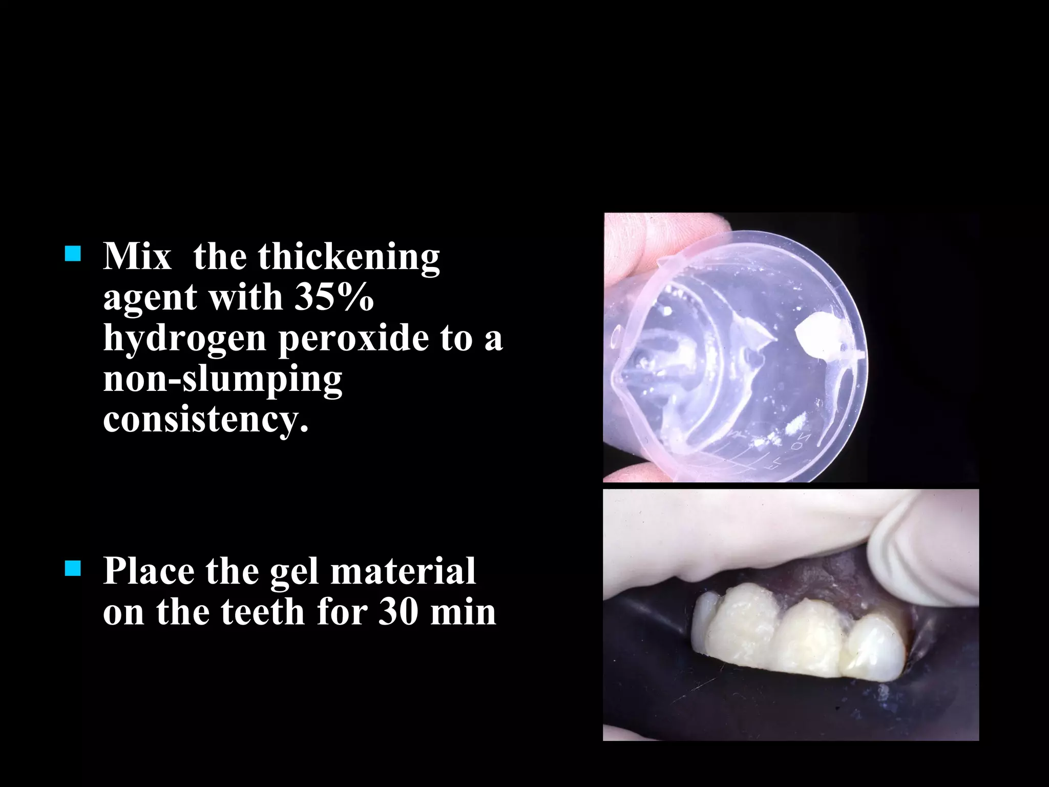 Bleaching | PPT